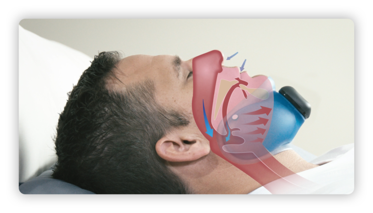 aerSleep | Sommetrics